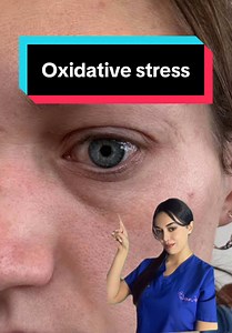 Understanding Oxidative Stress and Its Effects on Skin