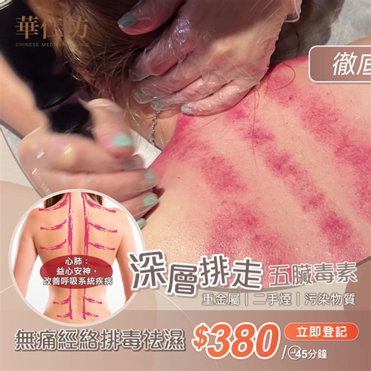 打工仔必試❣️經絡淤堵腰頸痛❓久坐不動痛到難安❗️ 🌿$380中醫排毒祛濕理療，通經絡解勞損～ ✅肩頸繃痛✅腰背沉緊✅肌肉勞損✅經絡淤堵 🧘‍♀️疏淋巴通經絡，痛症立緩～ 💆‍♂️拉開筋膜沾黏，倦意統統跑光！ ✨解決長期倦怠、頭重頭脹問題 📱預約：http://bit.ly/40PJojC ❤️網上付款再減$50❤️ 🔋中醫排毒祛濕理療🔋即時排除身體廢物👍🏻 1.註冊中醫痛症診斷 2.新式無痛刮痧療法 3.中醫解說「出痧」狀況 💡起痧顏色 ✖ 體內問題💡 🔴深紅色▶️體內有濕熱問題 🟣紫紅色▶️瘀熱濕重，多見肌肉痠痛僵硬 ⚫紫黑色▶️氣血瘀滯不通，常見有長期痛症 分店：📍銅鑼灣｜📍中環 ｜📍旺角｜📍荃灣 *只限於華仁坊之新客戶 *優惠期由即日起至另行通知 ୨୧┈┈┈┈┈┈┈┈┈┈┈┈┈┈┈┈୨୧ 【華仁坊中醫診所】 🔸超過20年經驗 🔸提供專科治療 🌎網站：wahyanfong.com ☎️電話：𝟵𝟬𝟲𝟰 𝟲𝟵𝟮𝟴 📱查詢/即日預約：https://wa.link/u09lch | 華仁坊中醫診所
