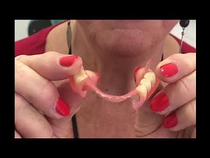 Valplast Denture