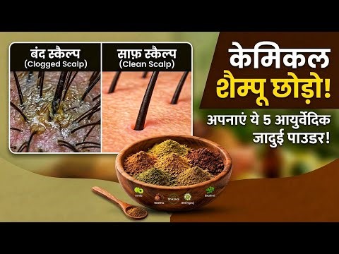 Ditch chemical shampoos! 5 Ayurvedic powders that will change your hair's fortunes. Stop hair fall.