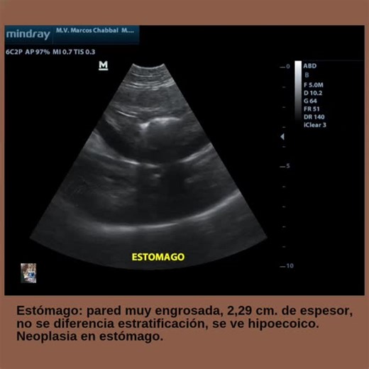 Acá te dejamos otro caso para que armes un e-book de casos. #cursosdeecografía #ecografiasmarcoschabbal #ecografíaveterinaria #ecografíaenpequeñosanimales | Ecografías Marcos Chabbal