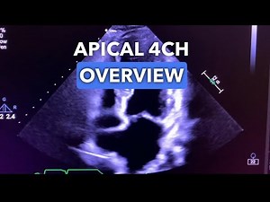 Apical 4 Chamber View - Echocardiography Education