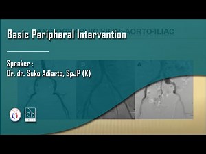 Basic Peripheral Intervention