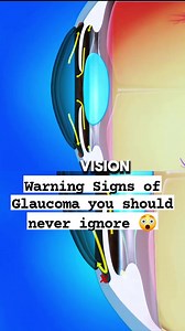 Warning Signs of Glaucoma you should never ignore 😲 Courtesy: The Health Crib #glaucoma #glaucomaawareness #eyes #eyeproblem #health #wellness #awareness #healthcare #eyesight #eyesightproblems | Mommy Che