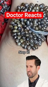 490K views · 701 reactions | Doctor Reacts to Satisfying “Tick” Removal | Doctor ER | Facebook