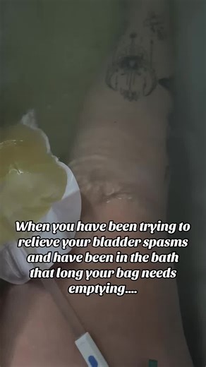 It’s a full one ❤️ #fyp #myjourney #foryoupage #mylife #normalisecatheters