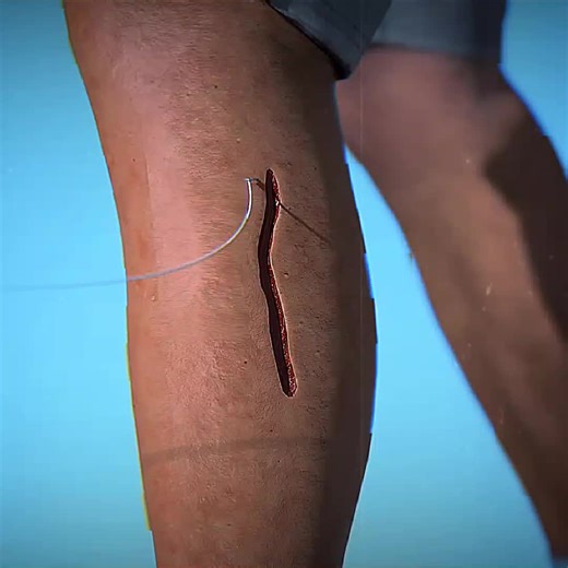 Understanding How Stitches Work in Animation