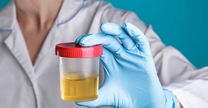 ECBU : en quoi consiste l’examen et ce qu’il faut savoir avant de faire des analyses d’urines