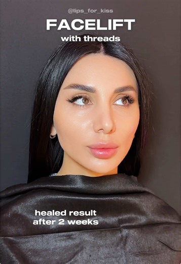 Thread Face Lifting: Results and Expert Appointments