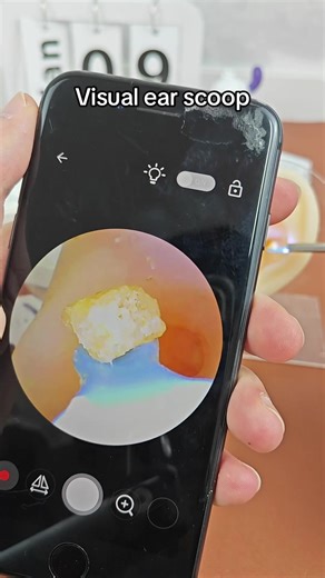 Visual Ear Spoon Camera for Earwax Removal