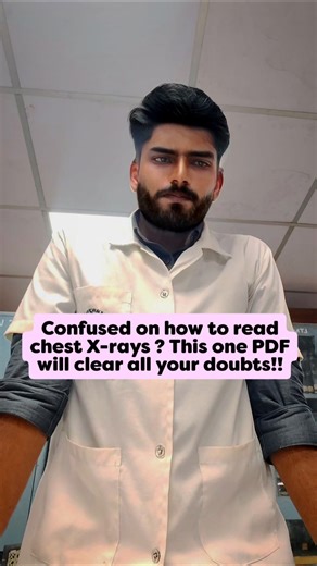 Read Any Chest X-ray 🩻 #shorts #savvymedico