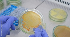 A scientist examines a Petri dish with orange bacteria in the laboratory and points to the dish with his index finger. Inspection of the results of the experiment. Stock Video