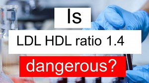 Is LDL HDL ratio 1.4 normal, high or low? What does LDL HDL ratio level 1.4 mean?