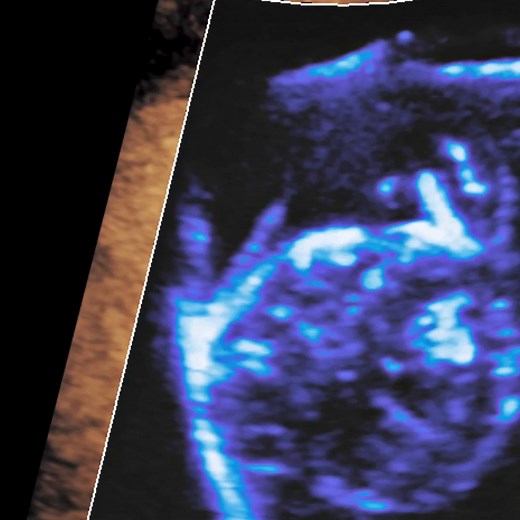 181 reactions · 41 shares | Artsen kunnen met MRI, CT, echo en röntgen in je lichaam kijken. Maar hoe werkt dit? Bekijk de video! | Philips | Facebook