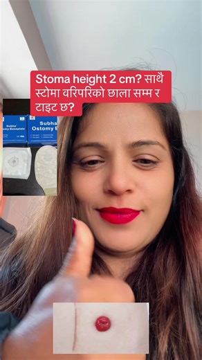 Understanding Stoma Height and Peristomal Skin Care