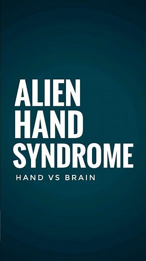 When Your Hand Rebels 🤚 (Alien Hand Syndrome Explained) #didyouknow #shorts #viral #science