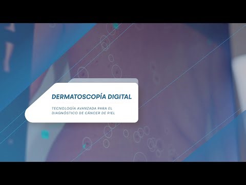 🙌🏻Dermatoscopía digital: la tecnología más avanzada para el diagnóstico de cáncer de piel