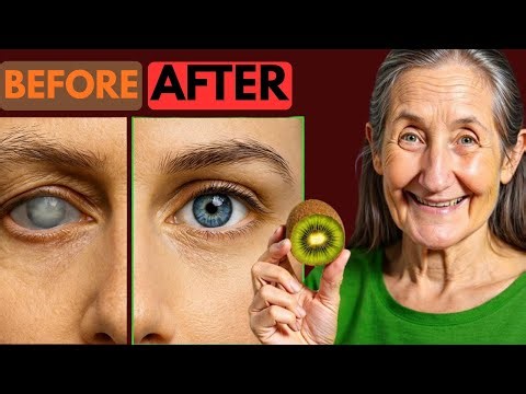 Eye Doctors Shocked: Reverse Vision Loss in Just 7 Days Naturally | Barbara O'Neill