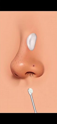 4K ASMR Deep Nose Treatment & Cleaning