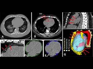 CT Heart segmentation using U-NET part two | training the model شرح عربي