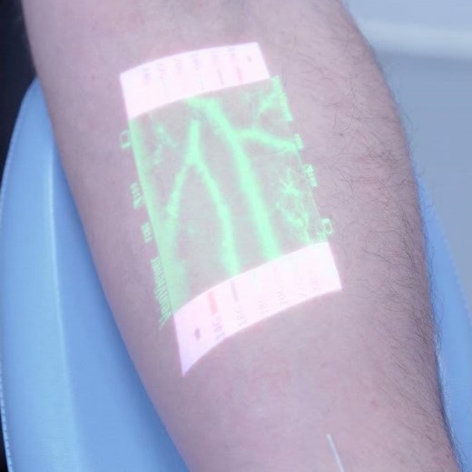 Navigate with CathCompass™ for VeinViewer®