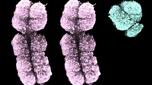 Developing a New Tool to Detect a Frequently Missed Sex Chromosome Disorder in Boys