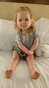 141K views · 3.2K reactions | #throwbackthursday to a livestream Ana and I did back in January 2019, right after her double leg surgery! She was just 3-years-old and we had spent the holidays at Quantum House while she underwent MAJOR double leg surgery and weeks of therapy/rehab so she could walk. She was so STINKING adorable!! :) #medicalvlog #familyvlog #surgery #learningtowalk #medicalrecovery #arthrogryposis #arthrogryposismultiplexcongenita #throwback | Team AMC Ana | Facebook