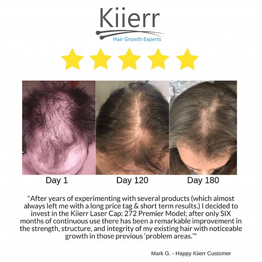 Kiierr Laser Cap Customer Reviews