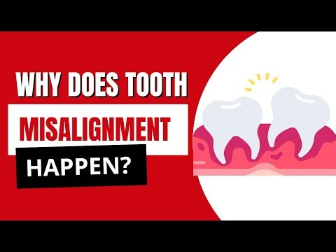 Why Does Tooth Misalignment Happen? Here's What to Know | Dental House MI