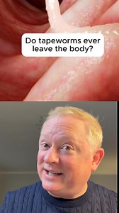 Do tapeworms leave the body even after death? #fbdecchallenge | Fun Funeral Facts