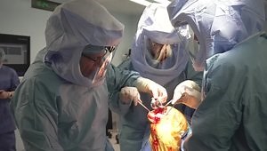 Kinematically Aligned Calipered Measured Linked Soft Tissue Guided Technique TKA