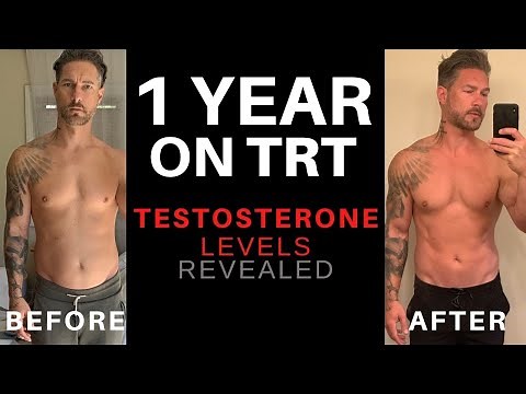 1 YEAR ON TRT - Testosterone Levels : Before & After
