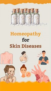 Homeoapathy for Skin Diseases . . . In this informative reel, Dr....
