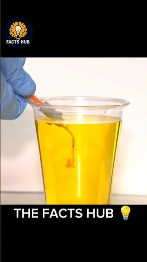 💉If You’re Afraid of Injections, Watch This Video! | Shocking Injection Facts