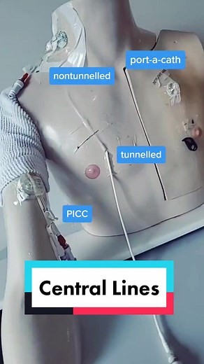 Mastering Central Line Insertion: Essential Nursing Skills