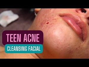 DEEP PORE CLEANSING FACIAL | CLOGGED PORES | DEEP EXTRACTIONS