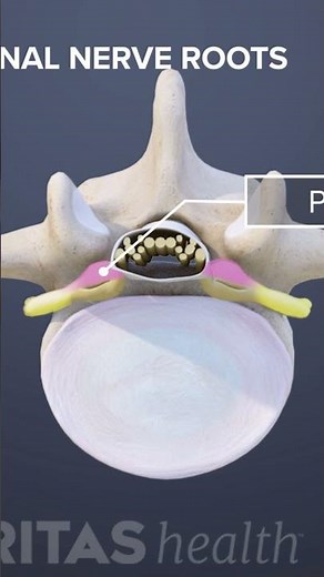 Lumbar Nerve Roots