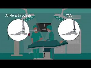 Surgeon Type and Outcomes After Inpatient Ankle Arthrodesis and Total Ankle Arthroplasty