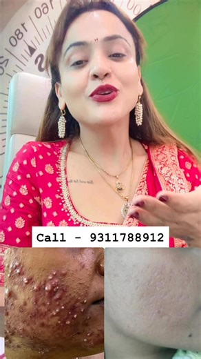Call - 9311788912 #hyperpigmentation #skincare #acne #skincareroutine #skincaretips #antiaging #glowingskin #skin #melasma #healthyskin #darkspots #acnescars #beauty #acnetreatment #esthetician #microneedling #skincareproducts #chemicalpeel #pigmentation #facial #facials #hyperpigmentationtreatment #naturalskincare #selfcare #clearskin #skincarecommunity #wrinkles #sundamage #sunspots #dermaplaning | Nisha Lambha - Sparsh Beauty Care & Hair Treatment LLP