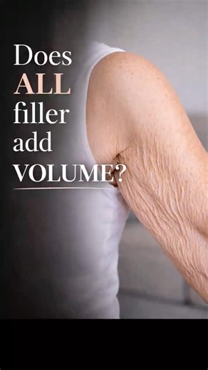 Filler Myth: Does It Always Add Volume?