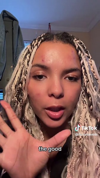 MyChart Class Action Lawsuit Insights