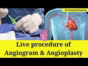 Live explanation of Coronary angiogram and angioplasty