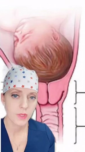 Cervical exams explained!