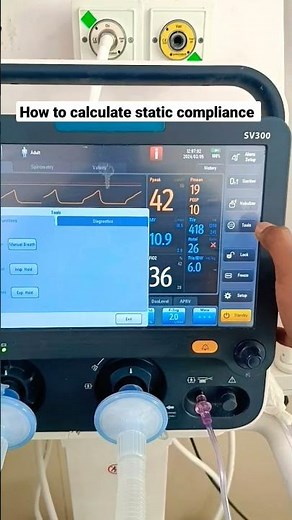 HOW to calculate static compliance #medical #medico #aiims #ventilator #mindray #icu
