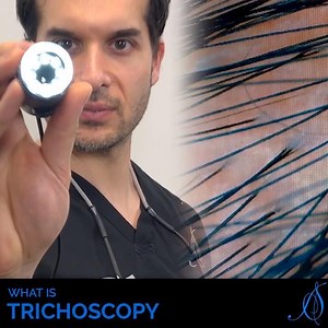 What Is Trichoscopy?