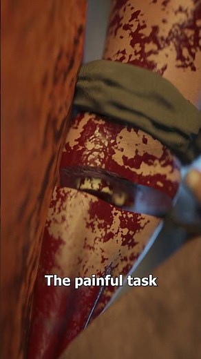 The Man Who Cut Off His Own Arm 😨