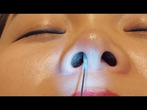 ASMR Clean your nose when your nose is stuffy. Nose clening