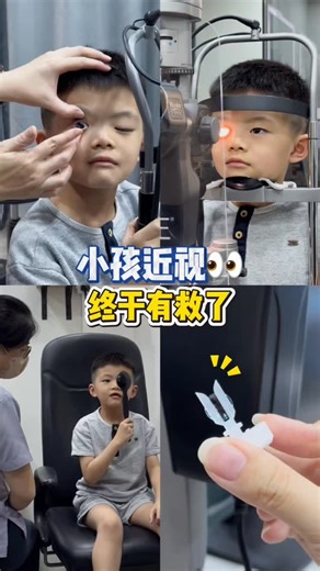 Worried about your child’s increasing myopia? 👶📉 Ortho-K lenses help slow myopia progression—worn at night, clear vision by day. Now available at Vision Optometry Kelana Jaya. #OrthoKKids #MyopiaManagement #ChildEyeCare #PJOptometrist | Vision Optometry Kelana Jaya