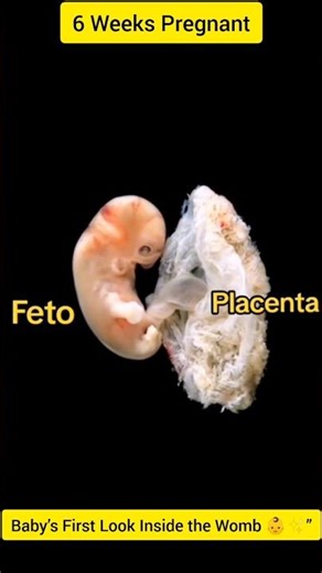 This is how tiny life begins ❤️ #6WeeksPregnant #BabyHeartbeat”