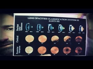 ASMR: Grading your Cataracts (blurry roleplay simulation)